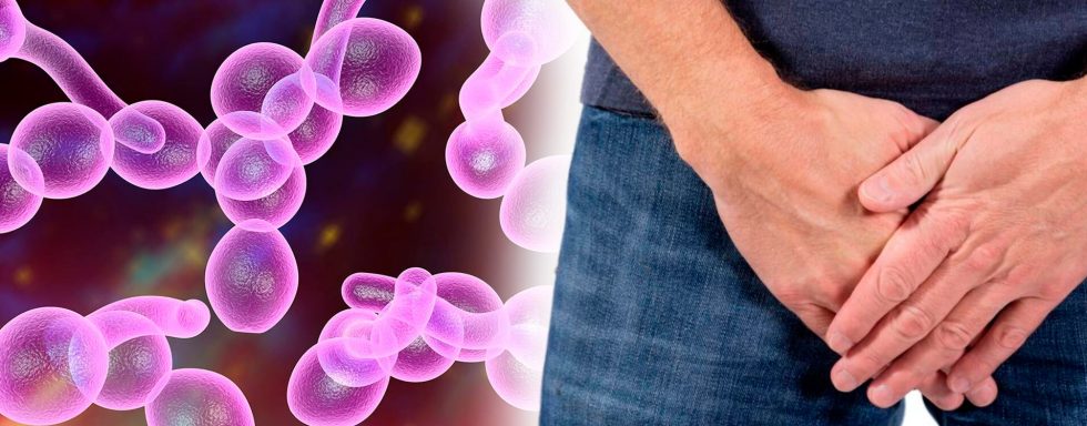 Candidiasis - Urólogo en Guadalajara